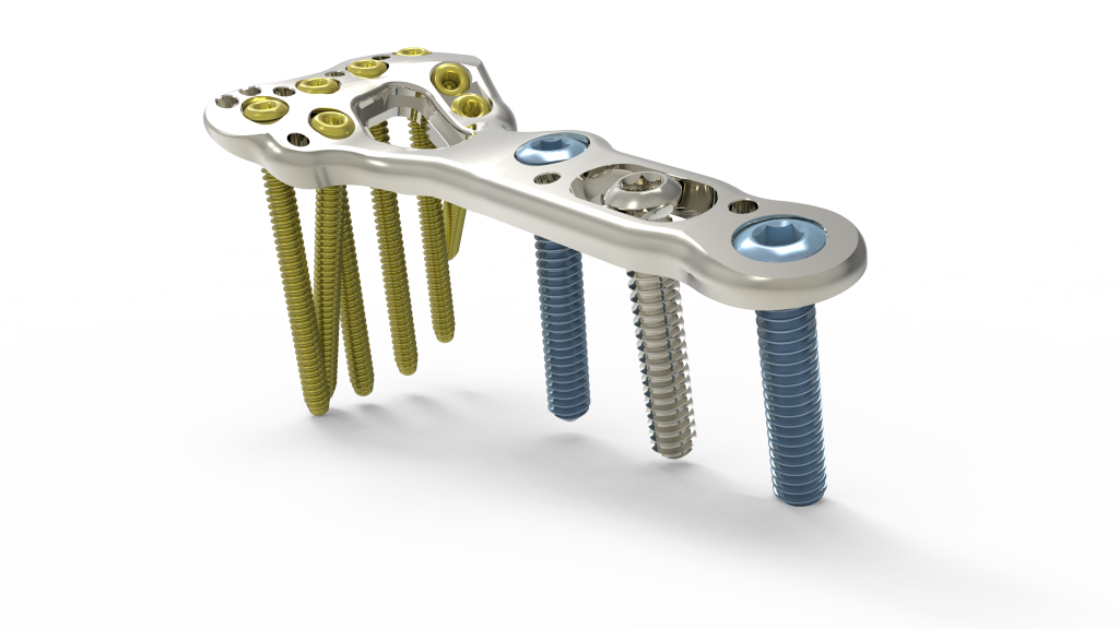 Acumed Acu Loc 2 Wrist Plating System Medical Optical