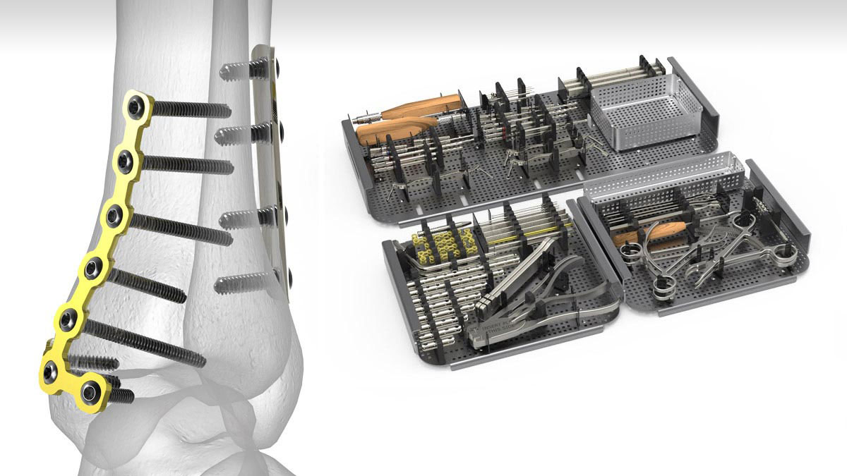 Acumed Small Fragment Base Set - Medical + Optical
