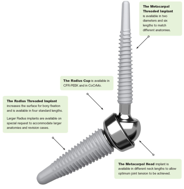 Motec Wrist Prothesis System - Medical + Optical