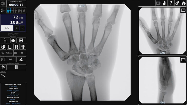 OrthoScan Versa - Medical + Optical